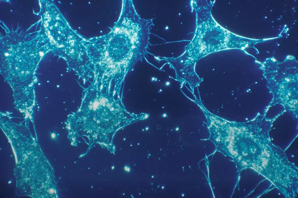 Single Cells from solid Tumors » TissueGrinder