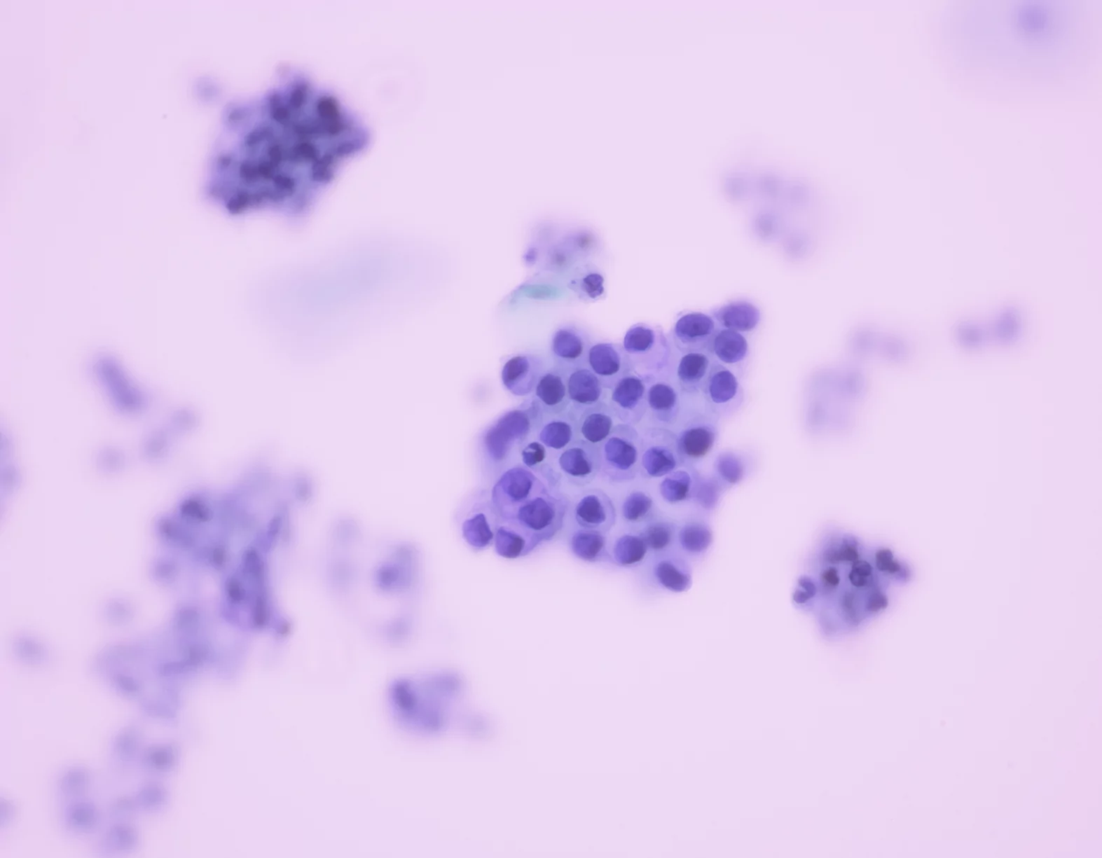 Tissue dissociation in